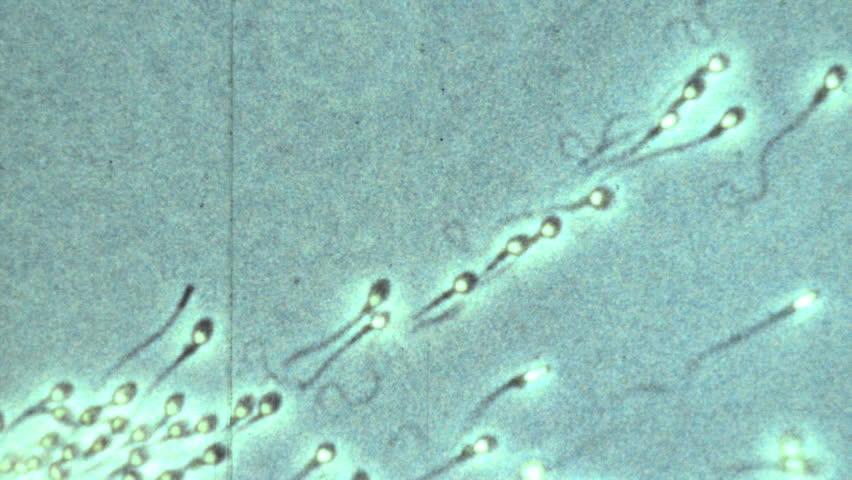 Sperm Cell Under Electron Microscope