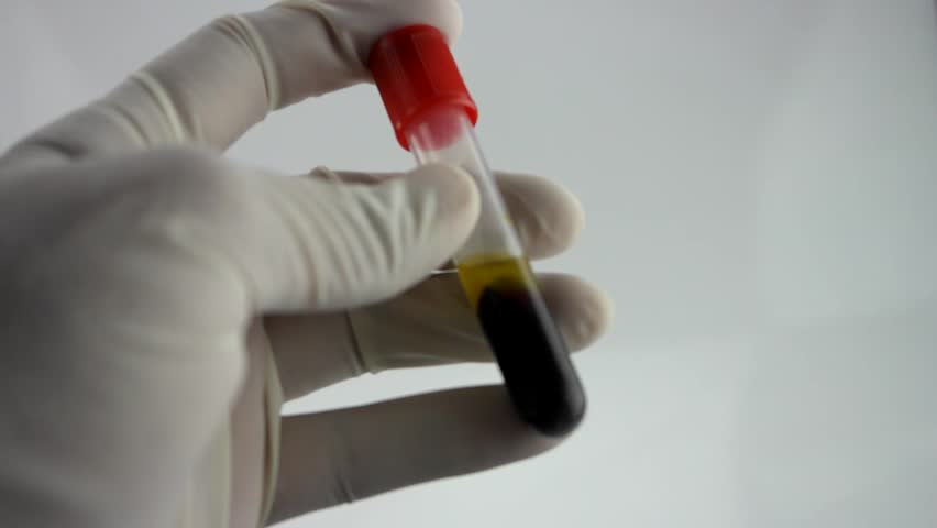 Hand Swirling Test Tube Of Blood On White Background In Slow Motion ...