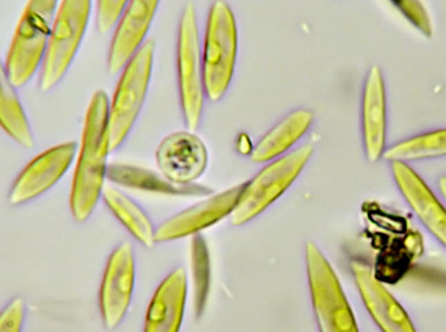 Water Algae Lab Sample 400x (HD). Microscopic Algae Seen At 400 Times ...