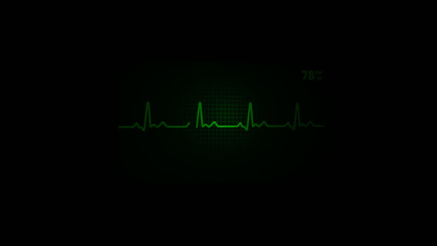 Animated Lifeline Stock Footage Video 3783149 - Shutterstock