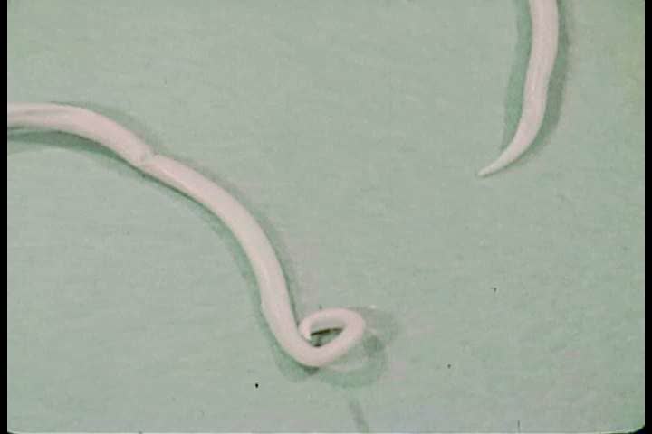 1960s - Parasitic Worms Infect Children Around The World. Stock Footage ...