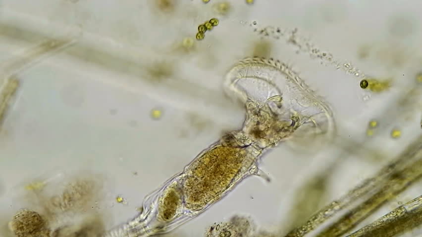 Live Microscopic Animal Rotifer Feeding Under Microscope 400x Stock ...