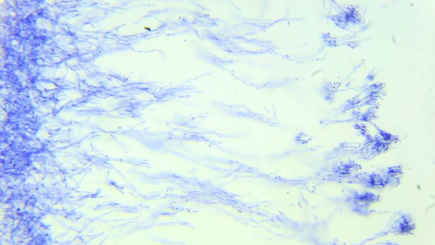 Penicillin Under The Microscope, (Penicillium W.M). Full HD Stock ...